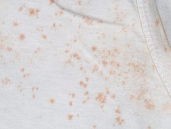 Effortless Hacks to Get Rid of Mold from Clothes