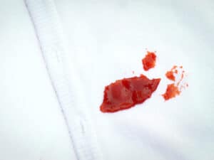 Ideal Ways to Banish Food Stains on Clothes Fast